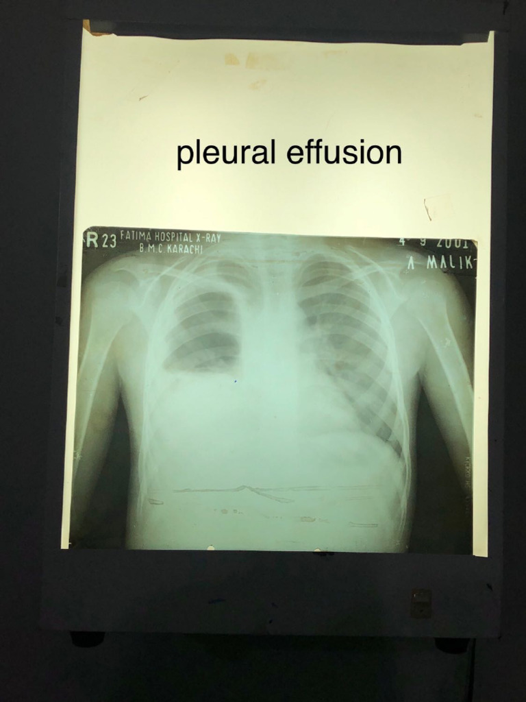Paeds Xrays | PDF