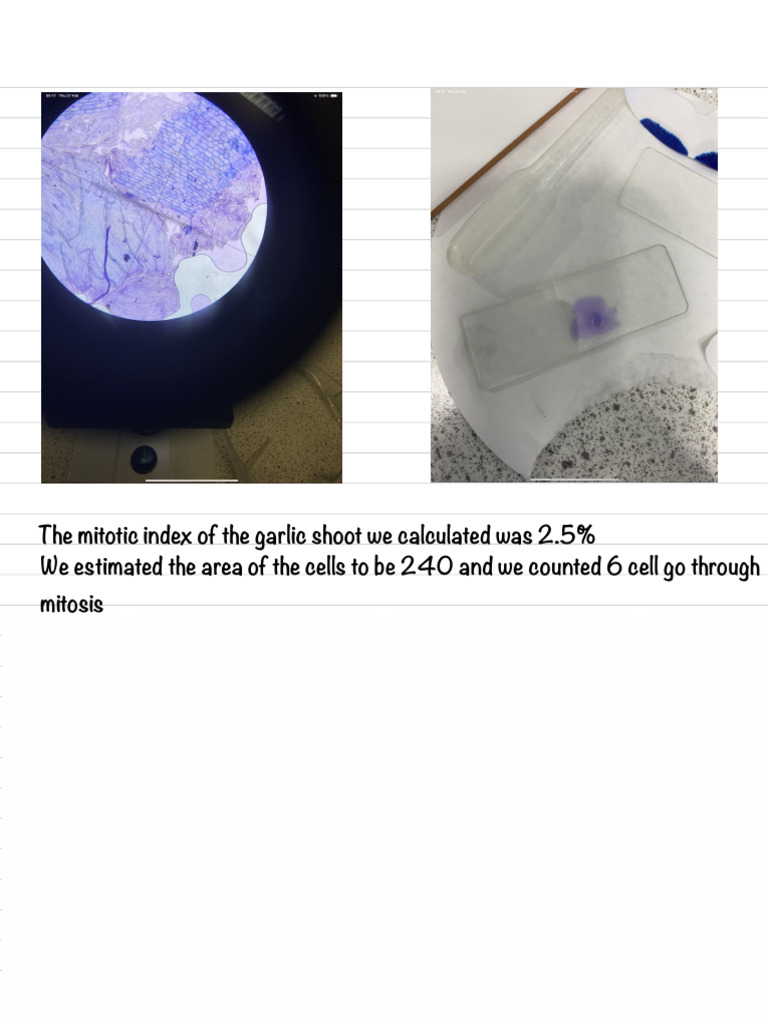 Mitosis Practical Ocr Bio | PDF