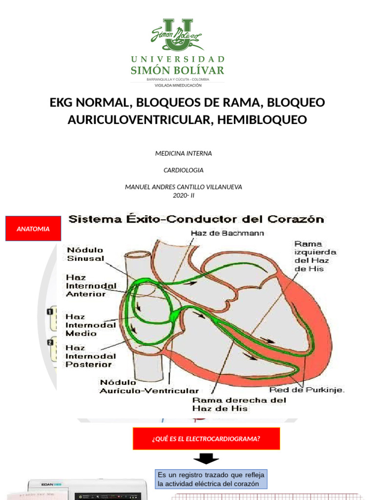Ekg Normal, Bloqueos de Rama, Bloqueo Auriculoventricular, Hemibloqueo ...