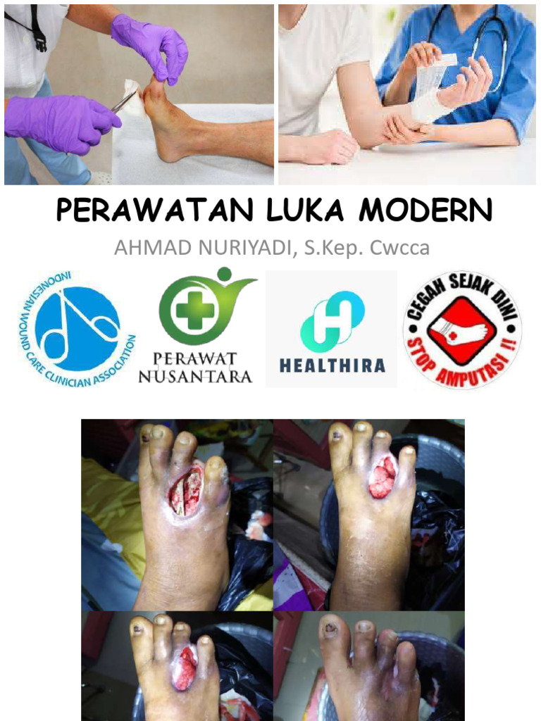 Panduan Perawatan Luka Modern | PDF