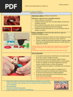 Protocolo Impresión Definitiva para Protesis Total | PDF | Dentadura ...