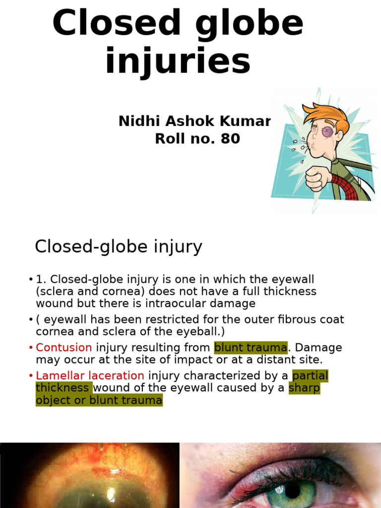 Closed Globe Injuries Overview | PDF | Glaucoma | Cornea