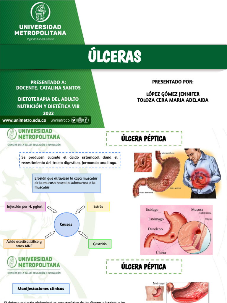 Tratamiento y Causas de Úlceras Pépticas | PDF | Estómago ...