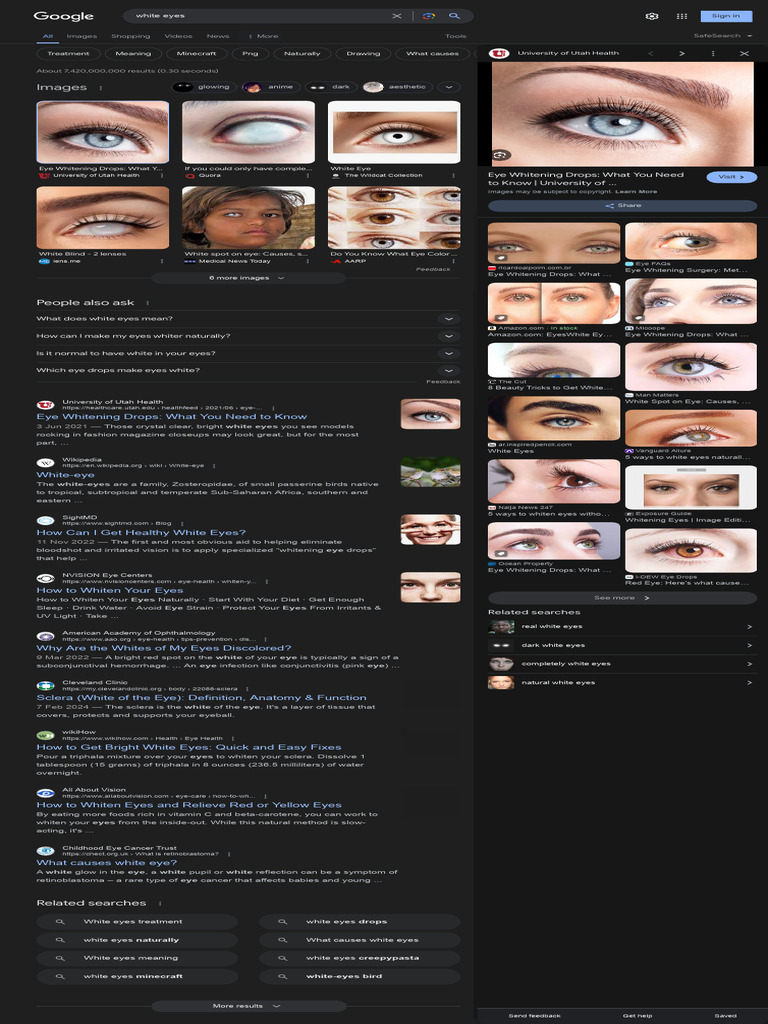white eyes - Google Search | PDF | Eye | Vision