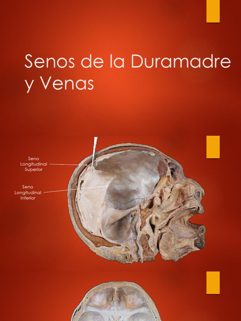Senos de La Duramadre y Venas de Cara y Cuello | PDF