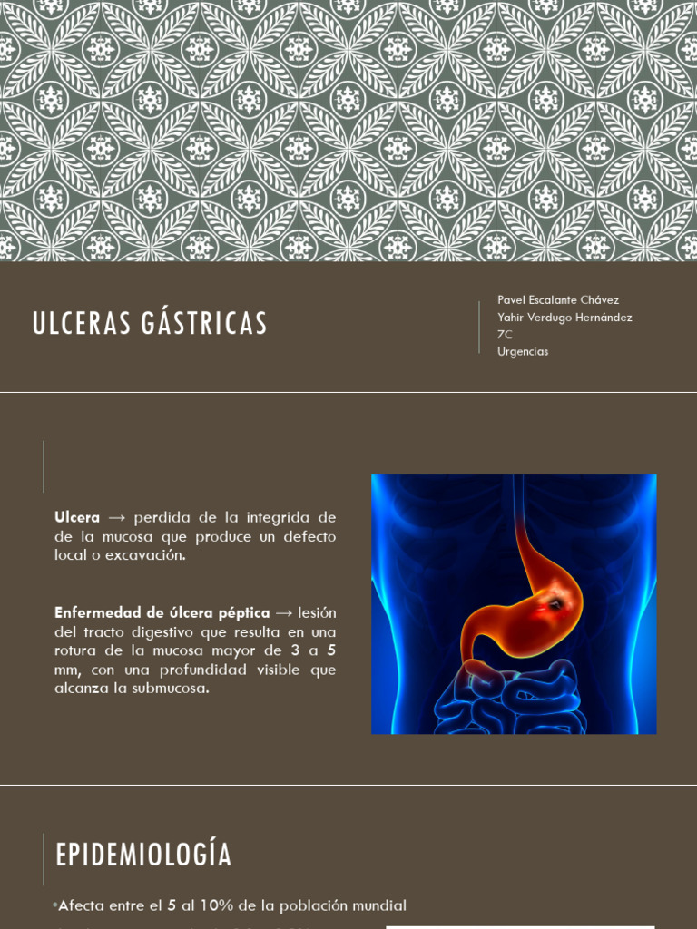 Ulceras Gástricas | PDF