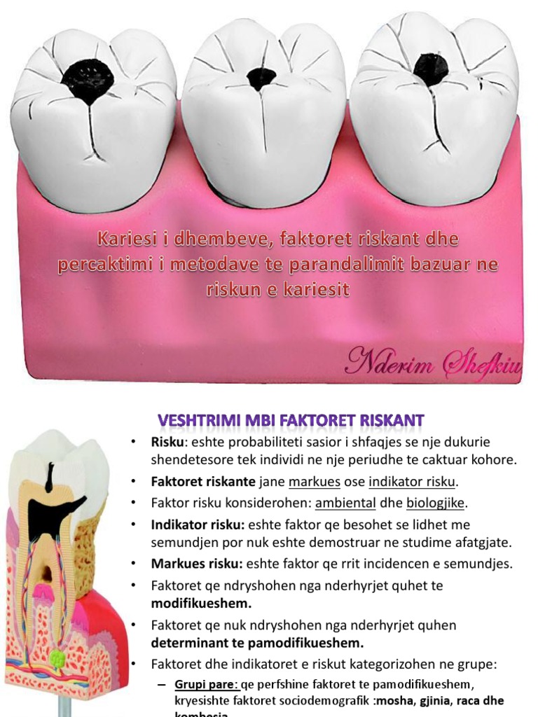 Kariesi I Dhembeve Dhe Faktoret Riskant Te Tij | PDF