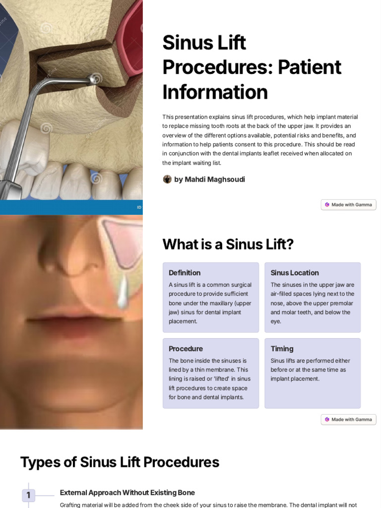 Sinus-Lift-Procedures-Patient-Information | PDF | Dental Implant | Surgery