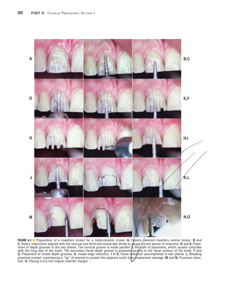 Clinical Procedures: Section: Figure 9-2 | PDF