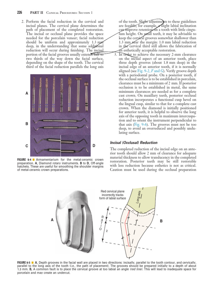 Metal-Ceramic Crown Preparation Guide | PDF | Dental Anatomy | Dentistry