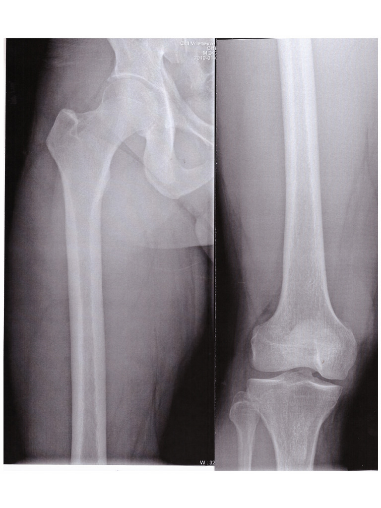 Science Document - Radio Femur Adulte | PDF