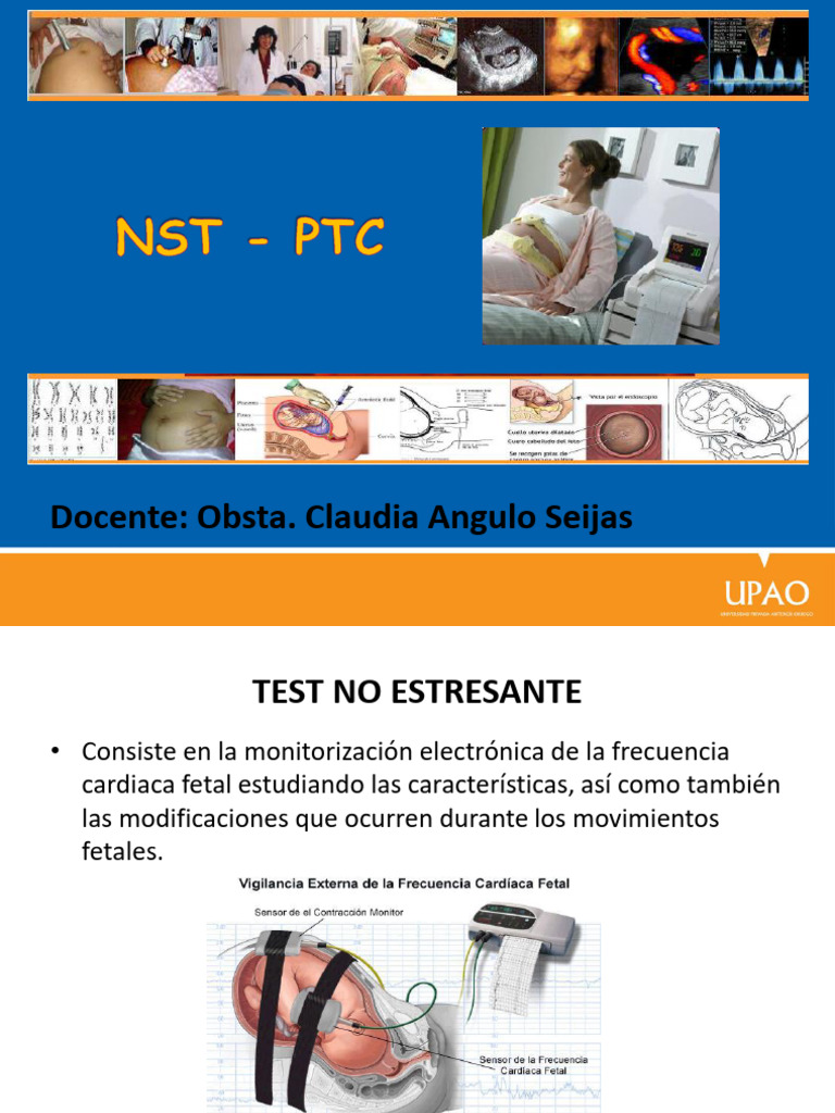 NST - PTC | PDF | El embarazo | Feto