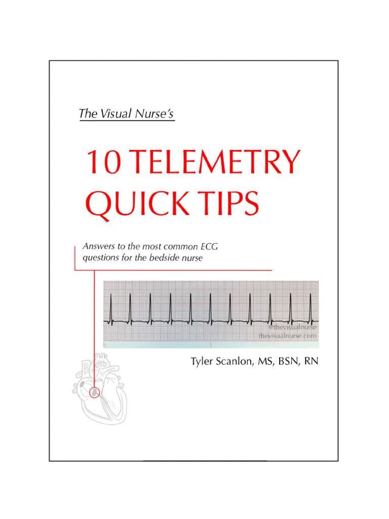10 Quick ECG Tips for Nurses | PDF | Atrium (Heart) | Heart