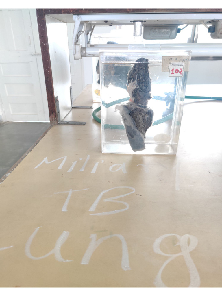 Pathology Gross Specimen All | PDF