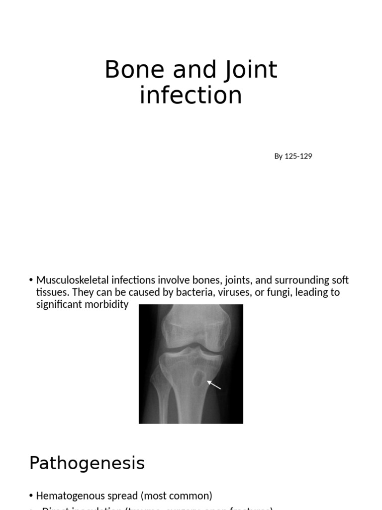 #Bone and Joint Infection | PDF