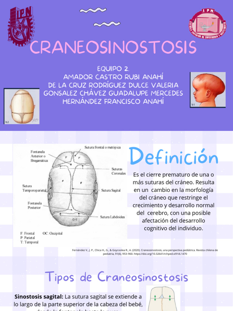 Craneosinostosis: Tipos y Diagnóstico | PDF | Dormir | Cráneo