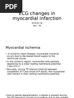 Right Ventricular Infarction • LITFL • ECG Library Diagnosis | PDF ...