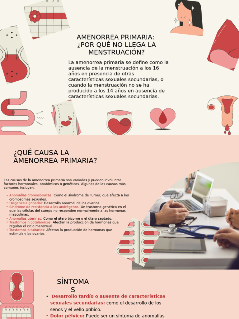 Amenorrea Primaria Mostrar Versiones | PDF