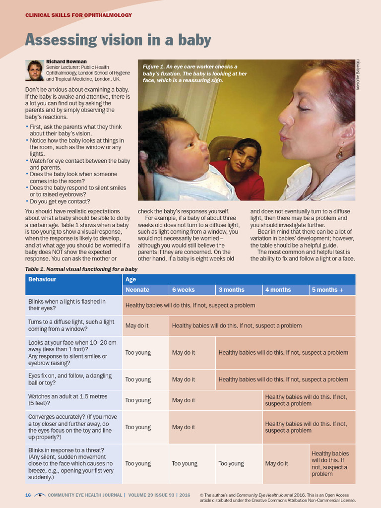 Assessing Vision in A Baby | PDF | Aperture | Infants