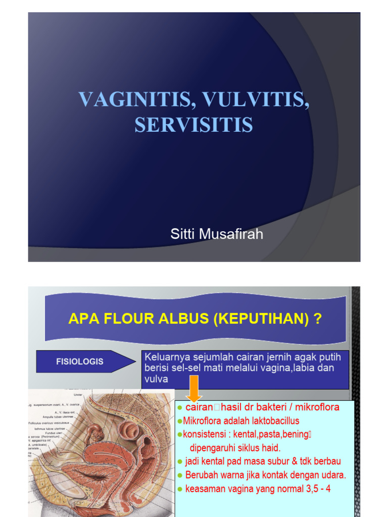 Vaginitis,vulvitis | PDF