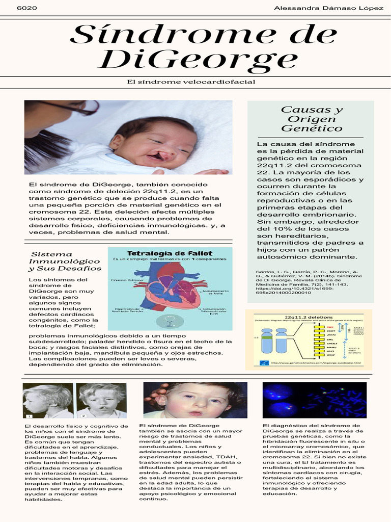 Infografía El Síndrome de Di George | PDF | Síndrome | Desorden hiperactivo y deficit de atencion