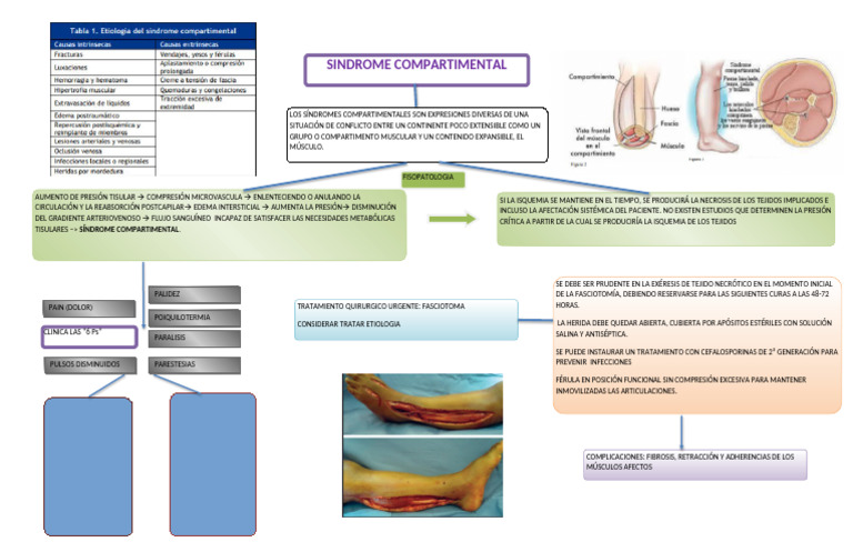 Sindrome Compartimental Ext | PDF | Fisiología | Medicina CLINICA