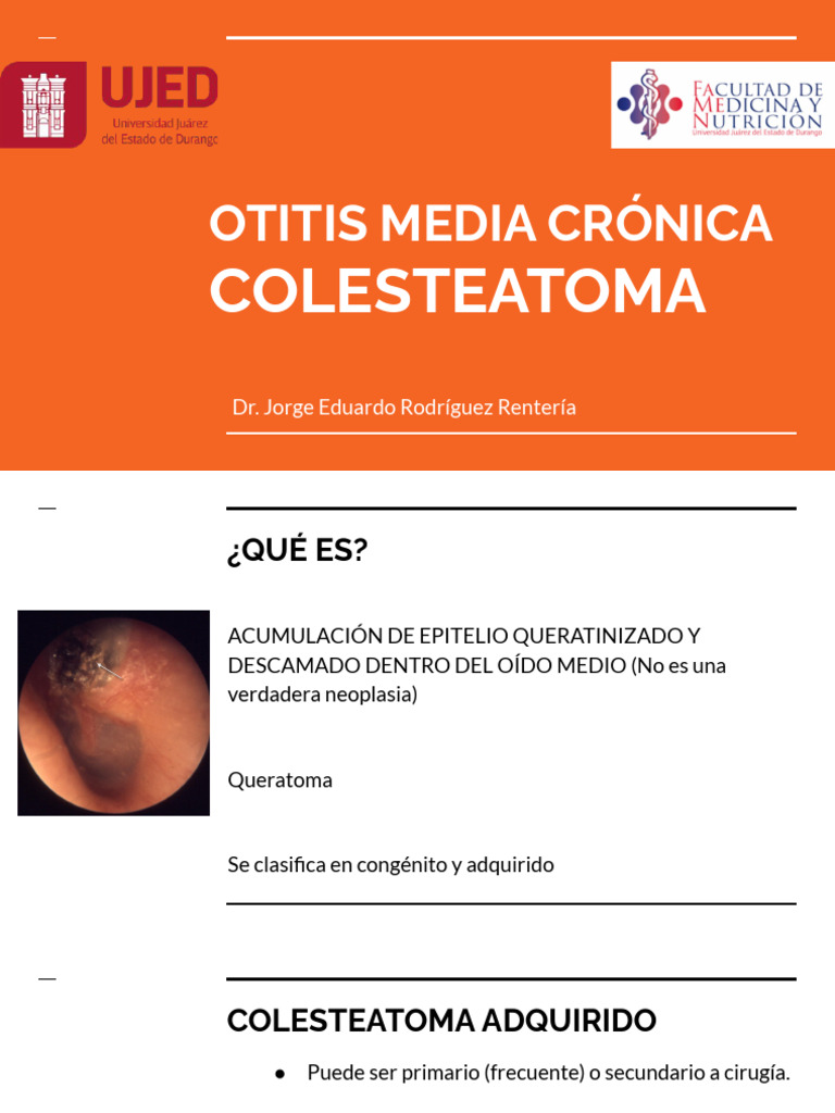 Otitis media (Colesteatoma y complicaciones) | PDF | Oído ...
