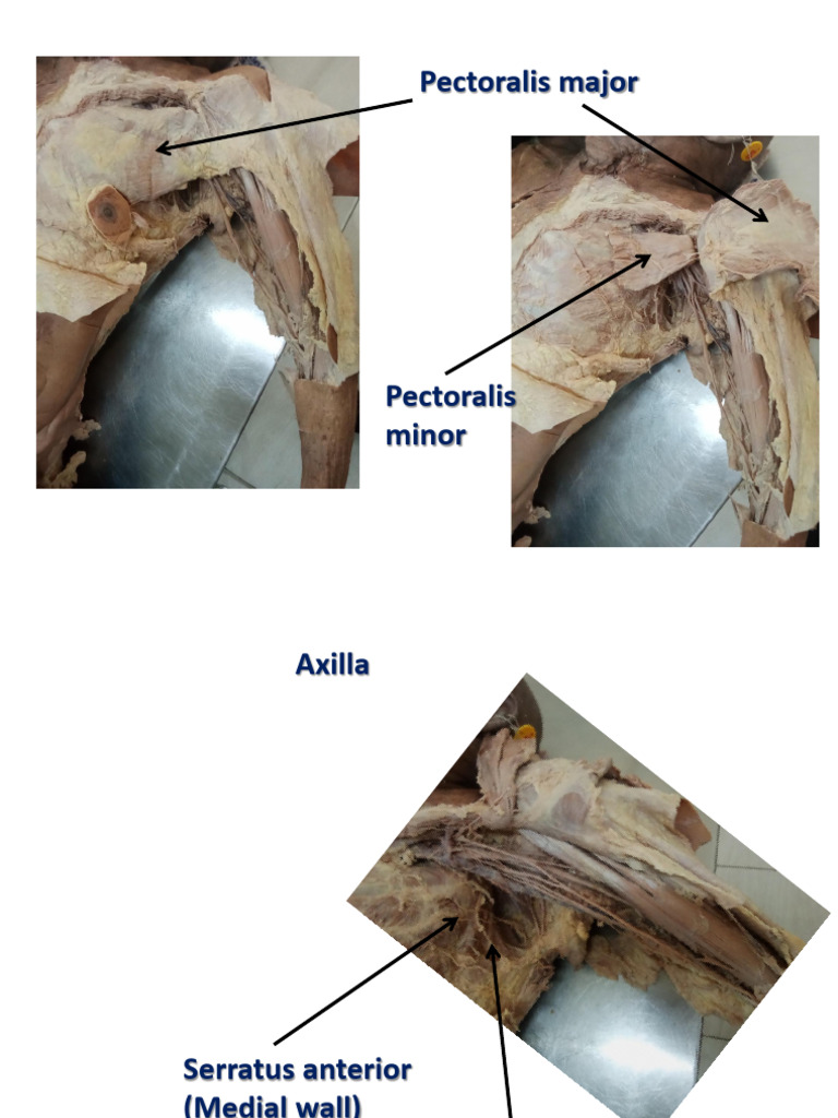 Anatomy Practical Revision 1 | PDF | Human Leg | Genetic Disorder