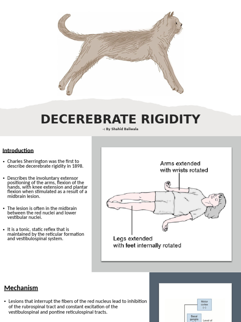 Decebrate Rigidity (By Shahid) | PDF