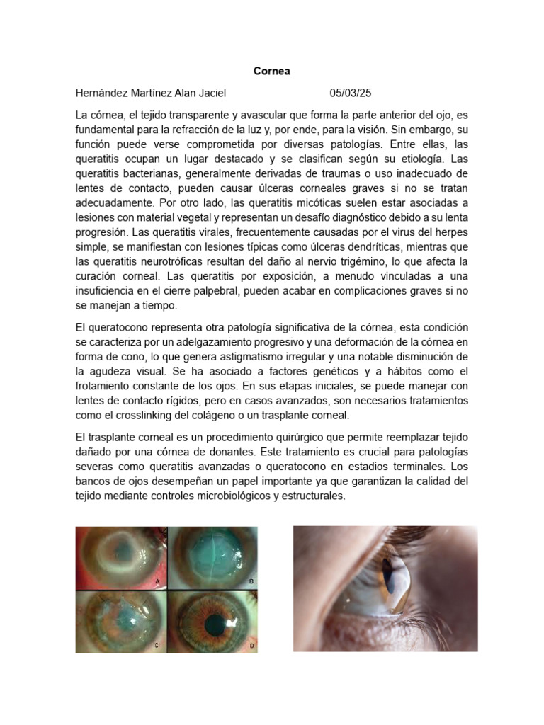 Cornea | PDF