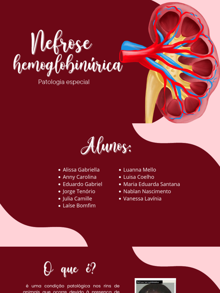 Nefrose Hemoglobiurica PDF | PDF