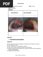 Mecv V | PDF