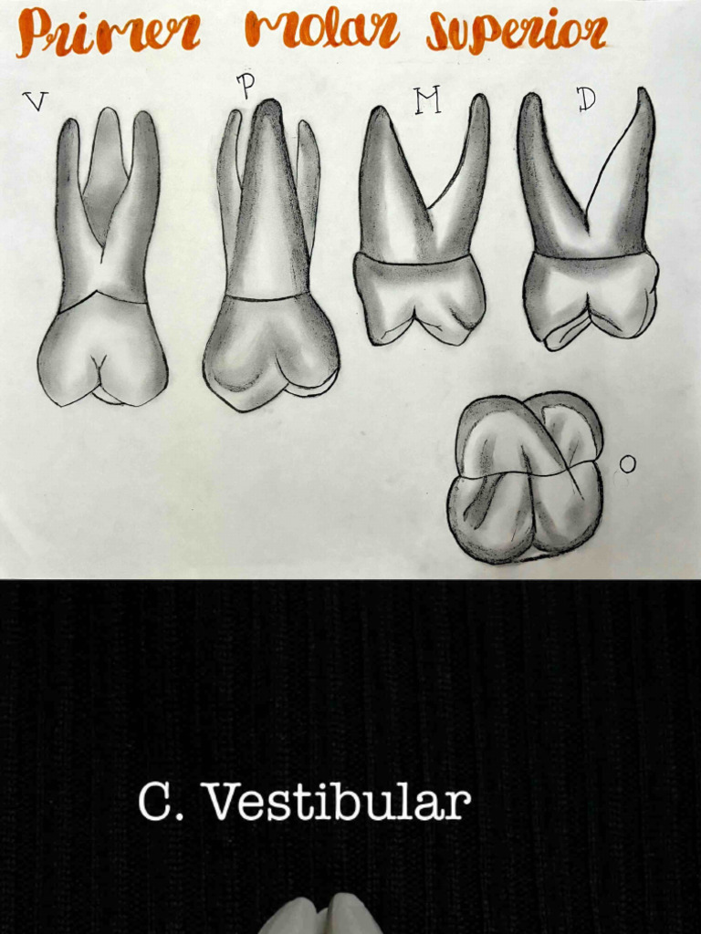 Anatomía del Primer Molar Superior | PDF