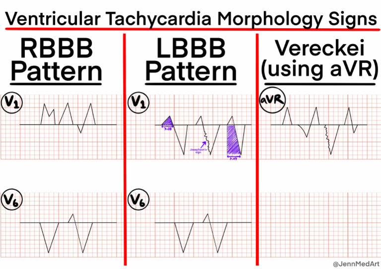 VT Morphological Signs - JJ | PDF