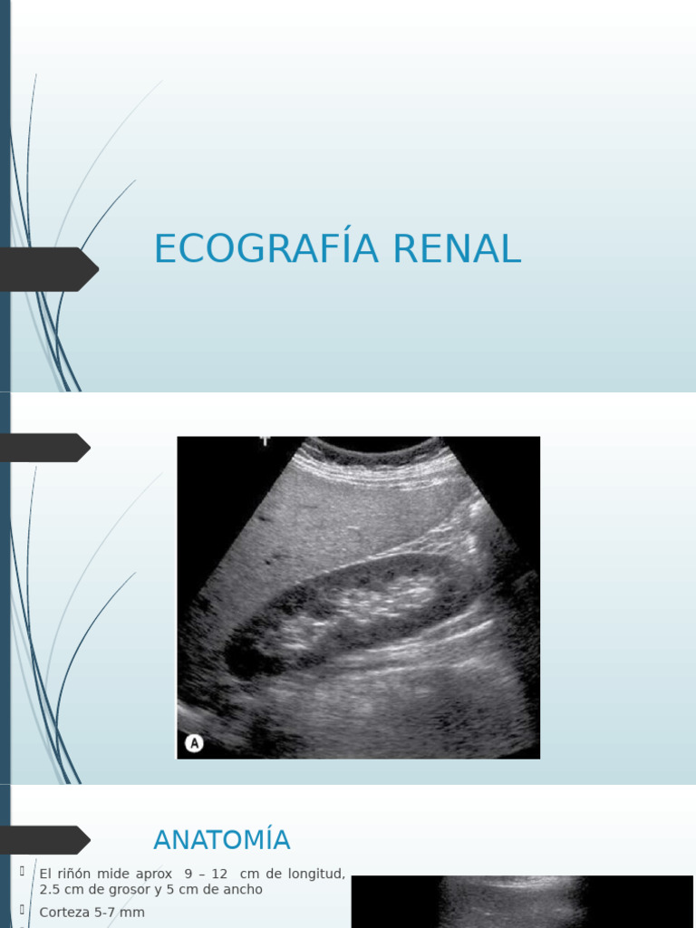 Ecografia-Renal 1 | PDF | Riñón | Urología