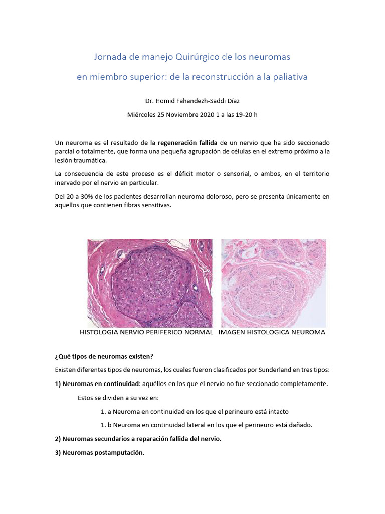 Manejo Quirúrgico de Neuromas en Mano | PDF | Nervio | Dolor