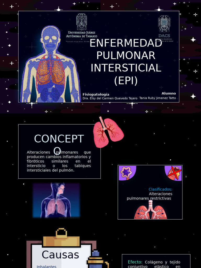 EPI (Enfermedad Pulmonar Intersticial | PDF | Medicina CLINICA | Enfermedades y trastornos humanos