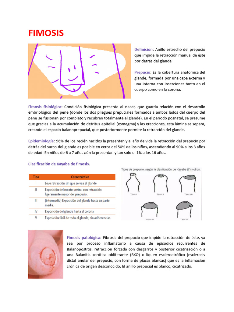 Fimosis y Parafimosis | PDF | Pene | Mamíferos machos
