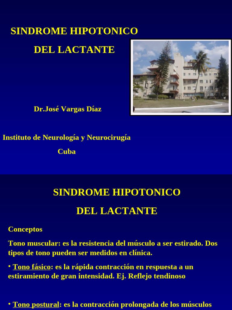 05 SINDROME HIPOTONICO 06 | PDF | Neurona motora | Nervio