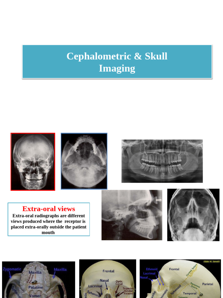 Section VII_Cephalometric & Skull Imaging | PDF | Skull | Human Head ...