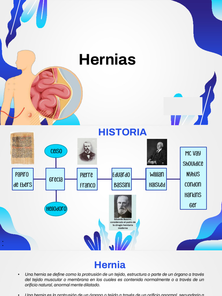 Hernias Listo | PDF | Abdomen