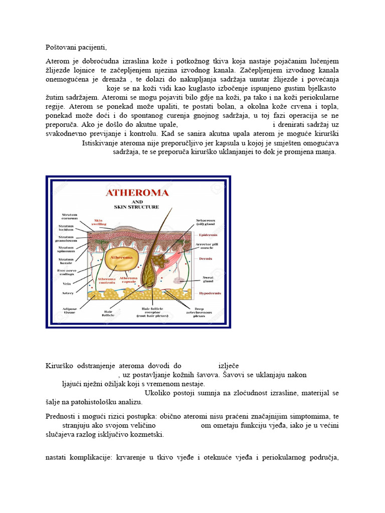 Mali Kirurski Zahvati Odstranjene Ateroma Periokularne Regije | PDF