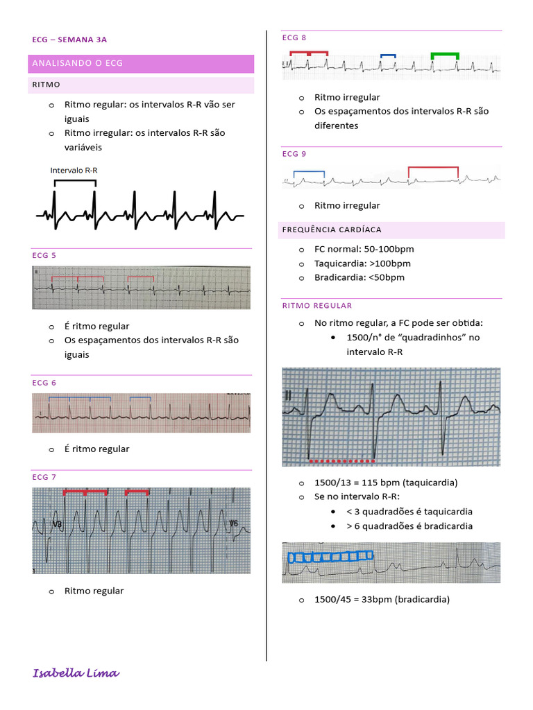 ECG - Semana 3A | PDF