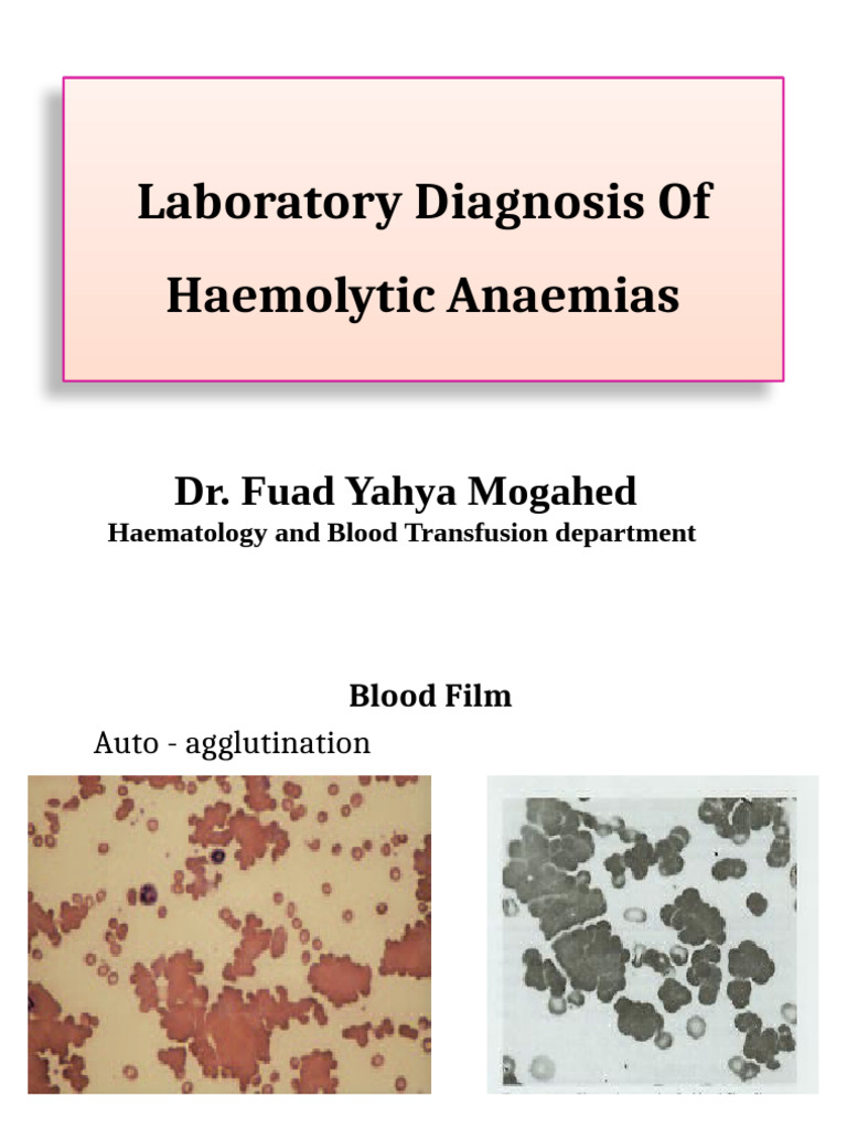 anemia Lab. diagnosis of HA 8 | PDF | Blood | Hematology