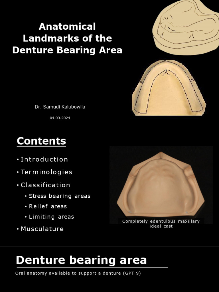 Anatomy of Edentulous Denture Bearing Area | PDF | Dentures ...