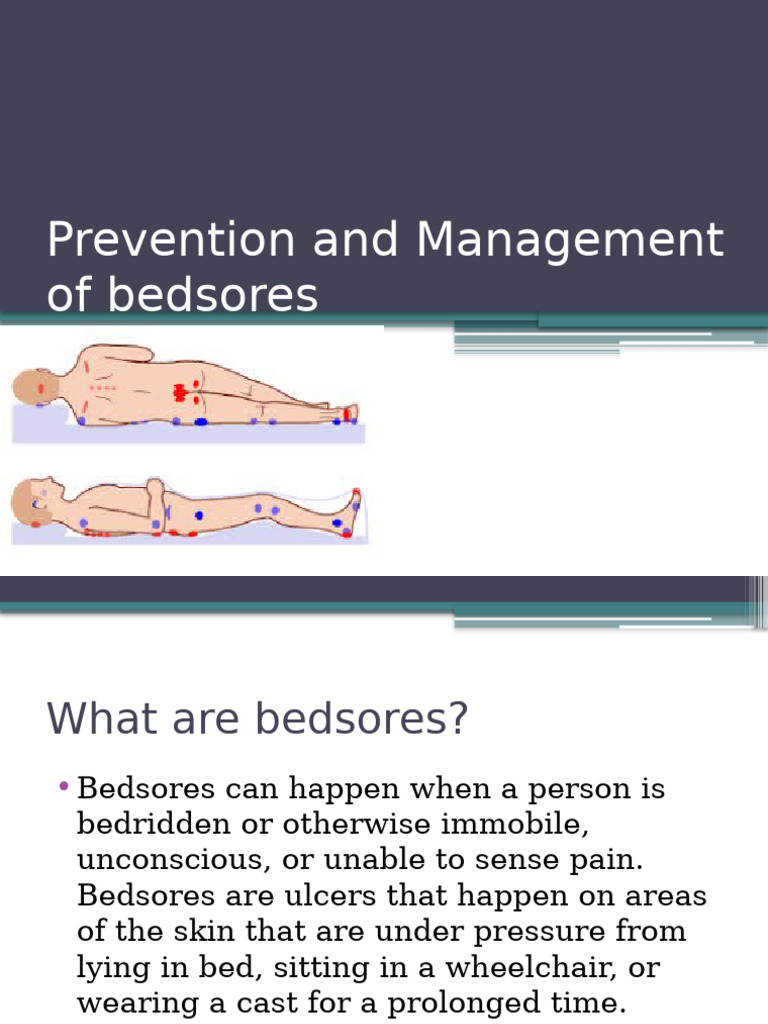 Bedsores: Prevention and Management Guide | PDF | Medical Specialties ...