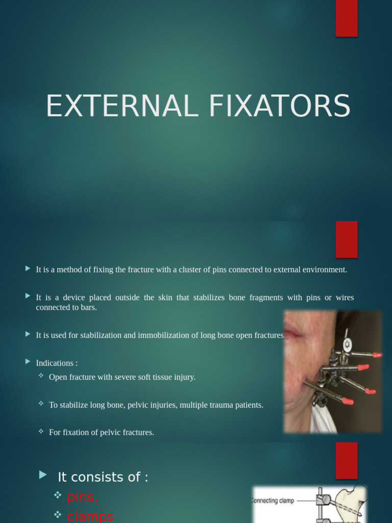 External Fixators | PDF | Amputation | Vertebral Column
