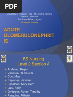 Acute Glomerulonephritis _AGN_ Nursing Care Plan | Edema | Hypertension