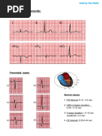 Left Anterior Fascicular Block (LAFB) - LITFL - ECG Library Diagnosis ...