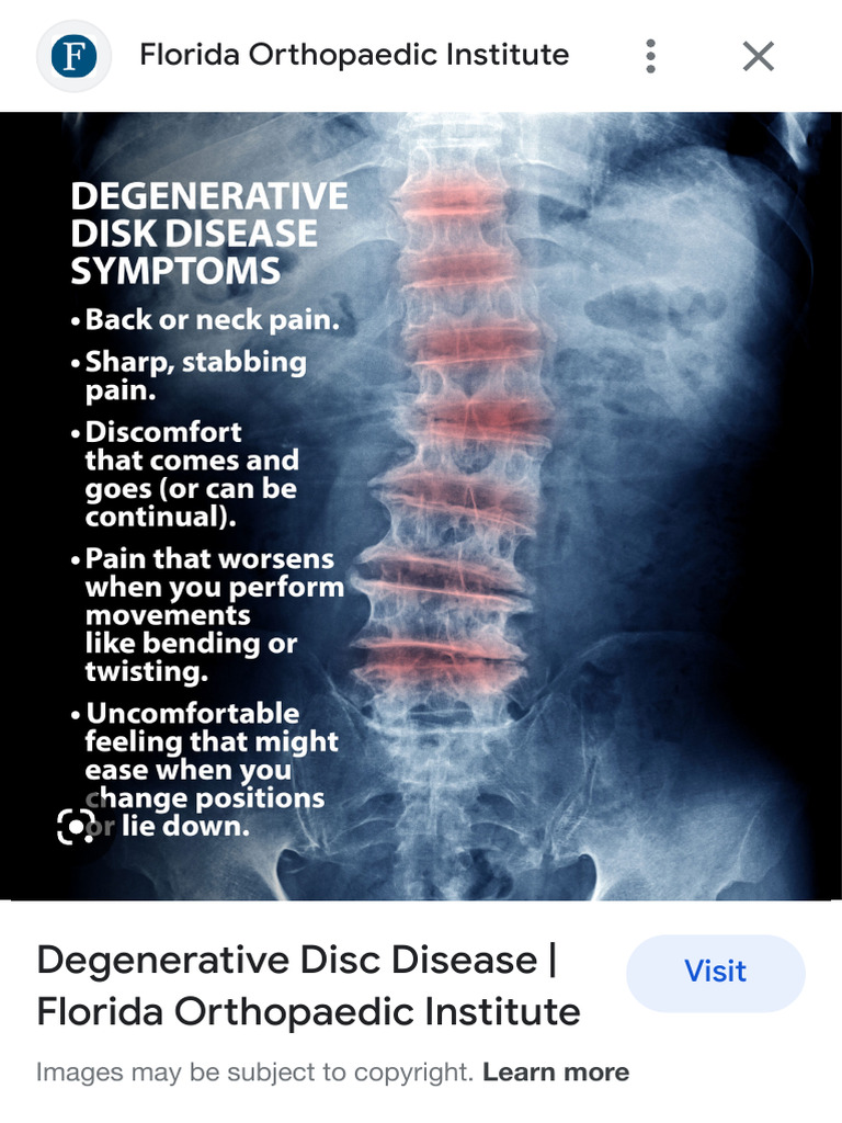 httpswww.google.comsearchq=degenerative+disc+disease&rlz=1CDGOYI ...